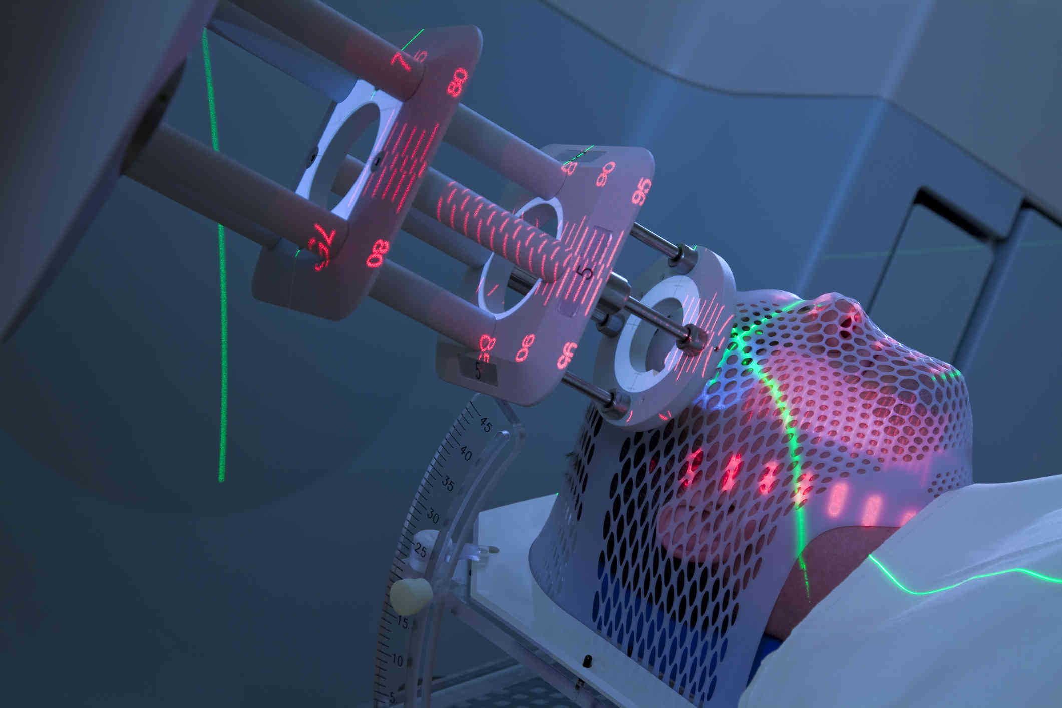 Medical Laser Technologies, Global Market, Cosmetic Procedures ...